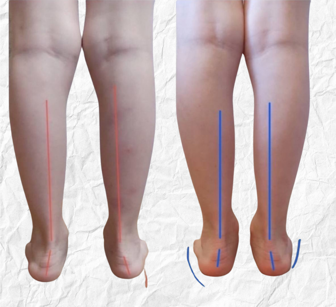 12 Months Access: Healthy Posture and Feet Course – ArgoPrep